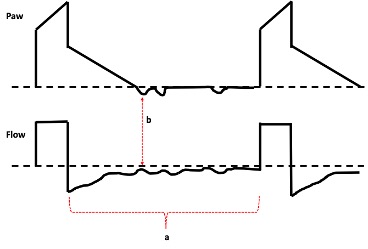 Patient ventilator synchrony - Intermediate - Open Critical Care