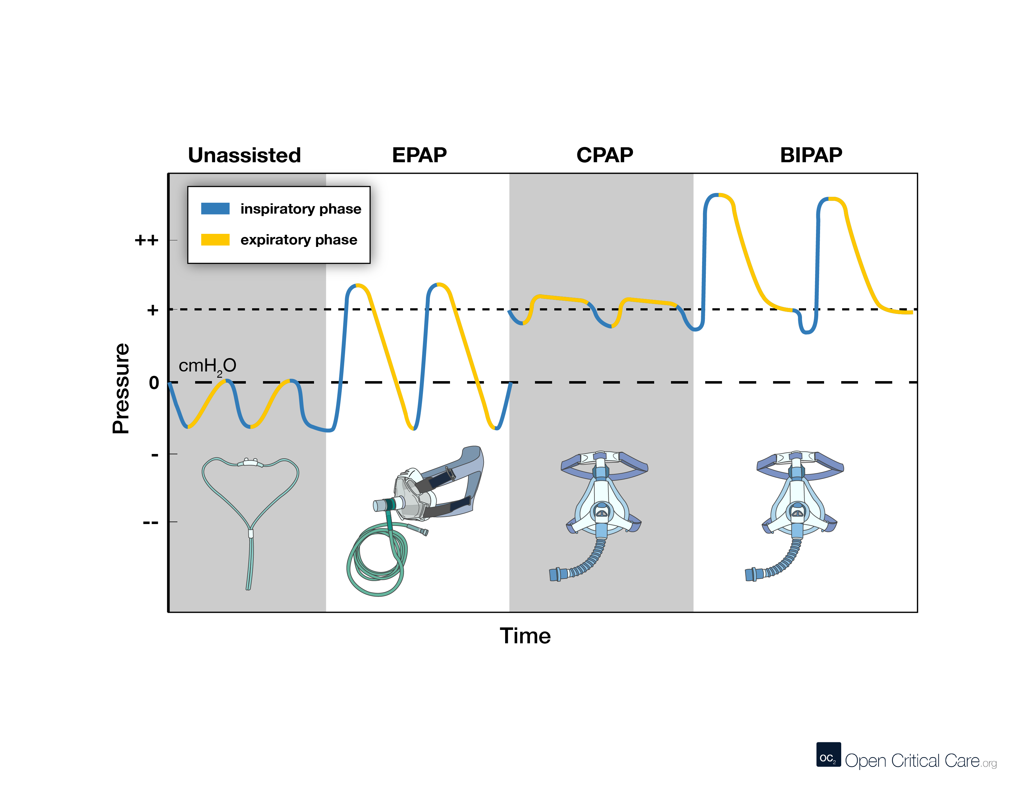 Bipap Vs Cpap Bipap Vs Cpap
